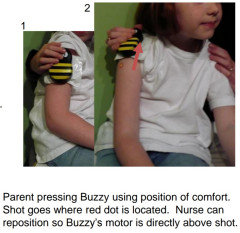 Update on my facial treatments...