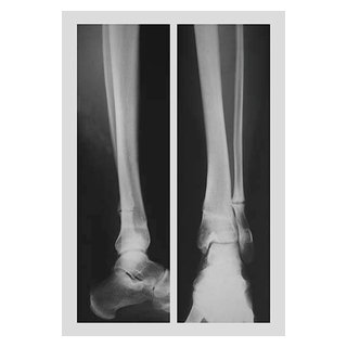 Two Ankles, 12" x 18" - Contemporary - Prints And Posters - by ...