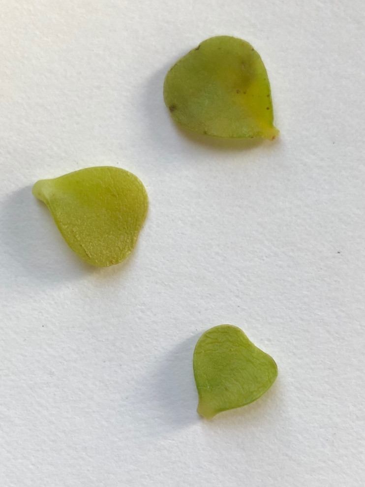 Dwarf Jade under or overwatered?